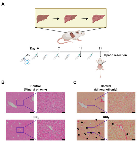 Activated Natural Killer Cell Inoculation Alleviates Fibrotic Liver ...
