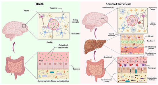 Gut Dysbiosis and Blood-Brain Barrier Alteration in Hepatic ...