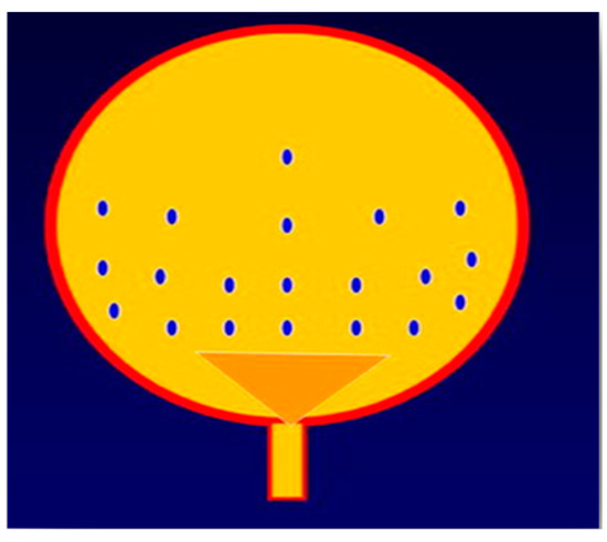 Onabotulinum Toxin A Intradetrusor Injections in Children with ...