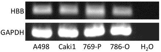 Hemoglobin β Expression Is Associated with Poor Prognosis in Clear Cell ...