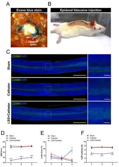 Epidural Injection Method for Long-Term Pain Management in Rats with ...
