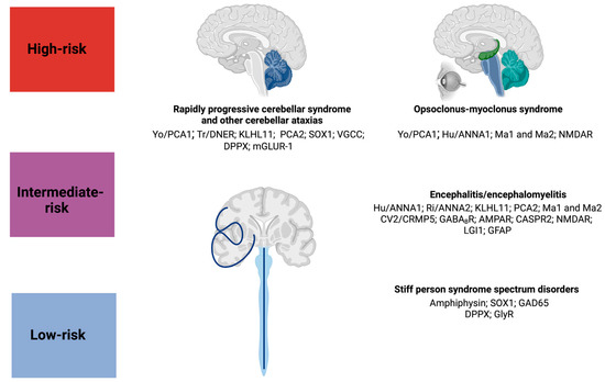 Paraneoplastic Neurological Syndromes of the Central Nervous System ...