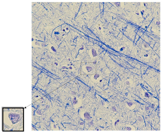 Biomedicines | Free Full-Text | Morphologic Findings in the Cerebral ...