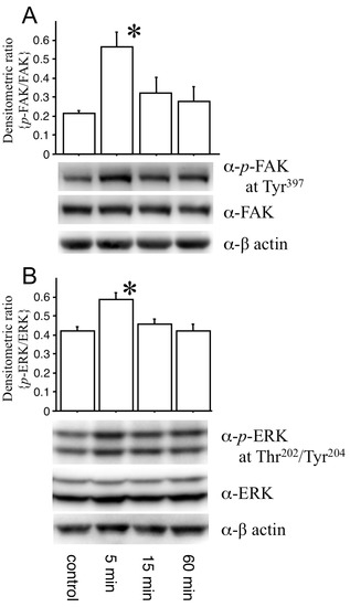 Angiogenesis in the Outer Membrane of Chronic Subdural Hematomas ...
