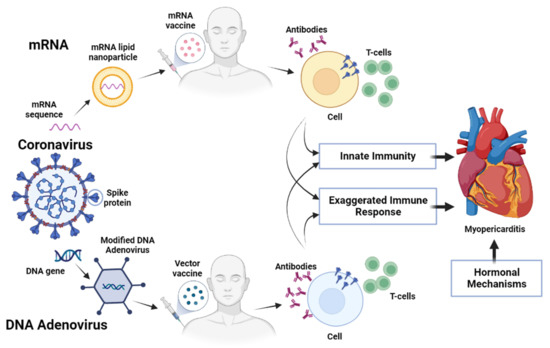 COVID-19 Vaccines and Myocarditis: An Overview of Current Evidence