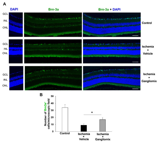 Neuroprotective Effect of a Nutritional Supplement Containing Spearmint ...