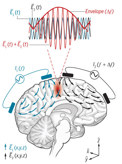 Noninvasive Electrical Stimulation Neuromodulation and Digital Brain ...