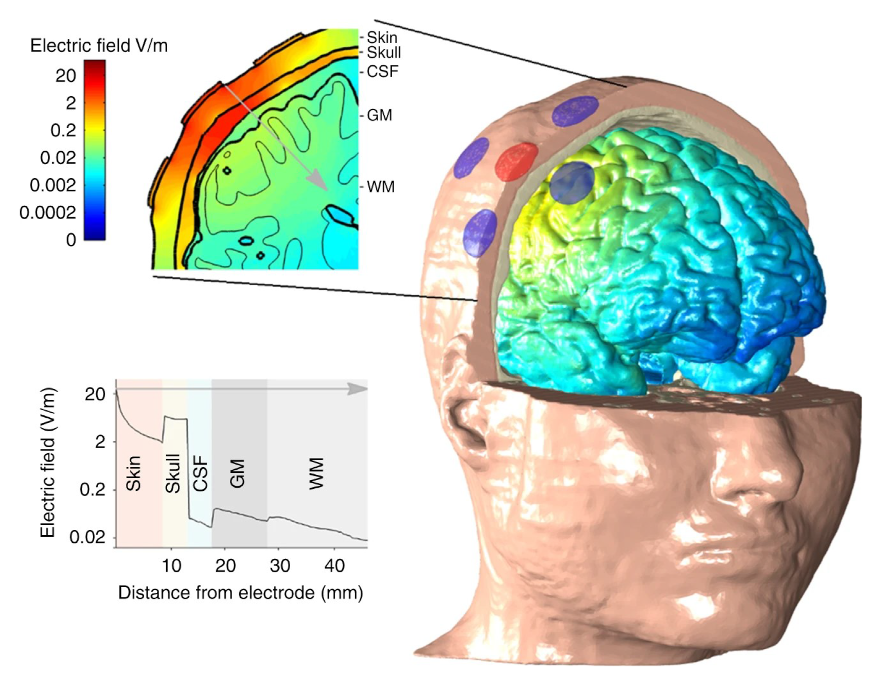 Noninvasive Electrical Stimulation Neuromodulation and Digital Brain Technology: A Review