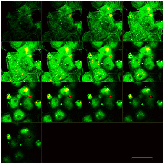 Interaction of Drug-Sensitive and -Resistant Human Melanoma Cells with ...