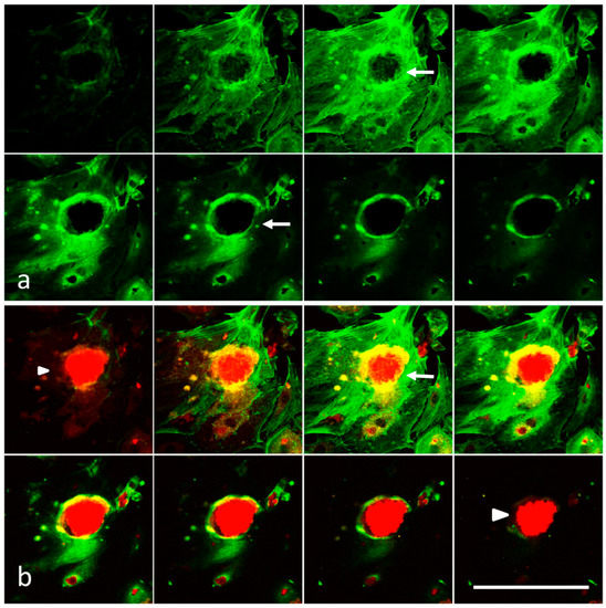 Interaction of Drug-Sensitive and -Resistant Human Melanoma Cells with ...