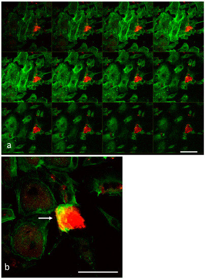 Interaction of Drug-Sensitive and -Resistant Human Melanoma Cells with ...