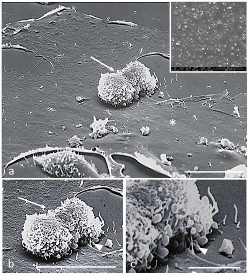 Interaction of Drug-Sensitive and -Resistant Human Melanoma Cells with ...