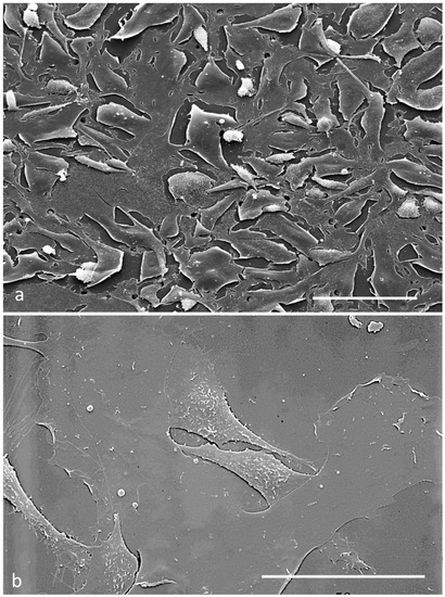 Interaction of Drug-Sensitive and -Resistant Human Melanoma Cells with ...