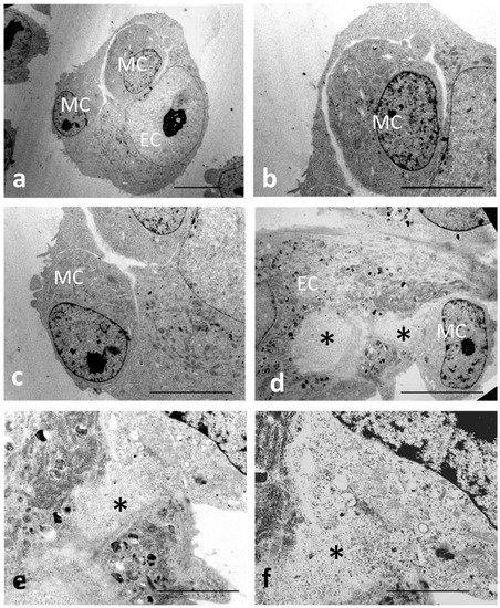 Interaction of Drug-Sensitive and -Resistant Human Melanoma Cells with ...