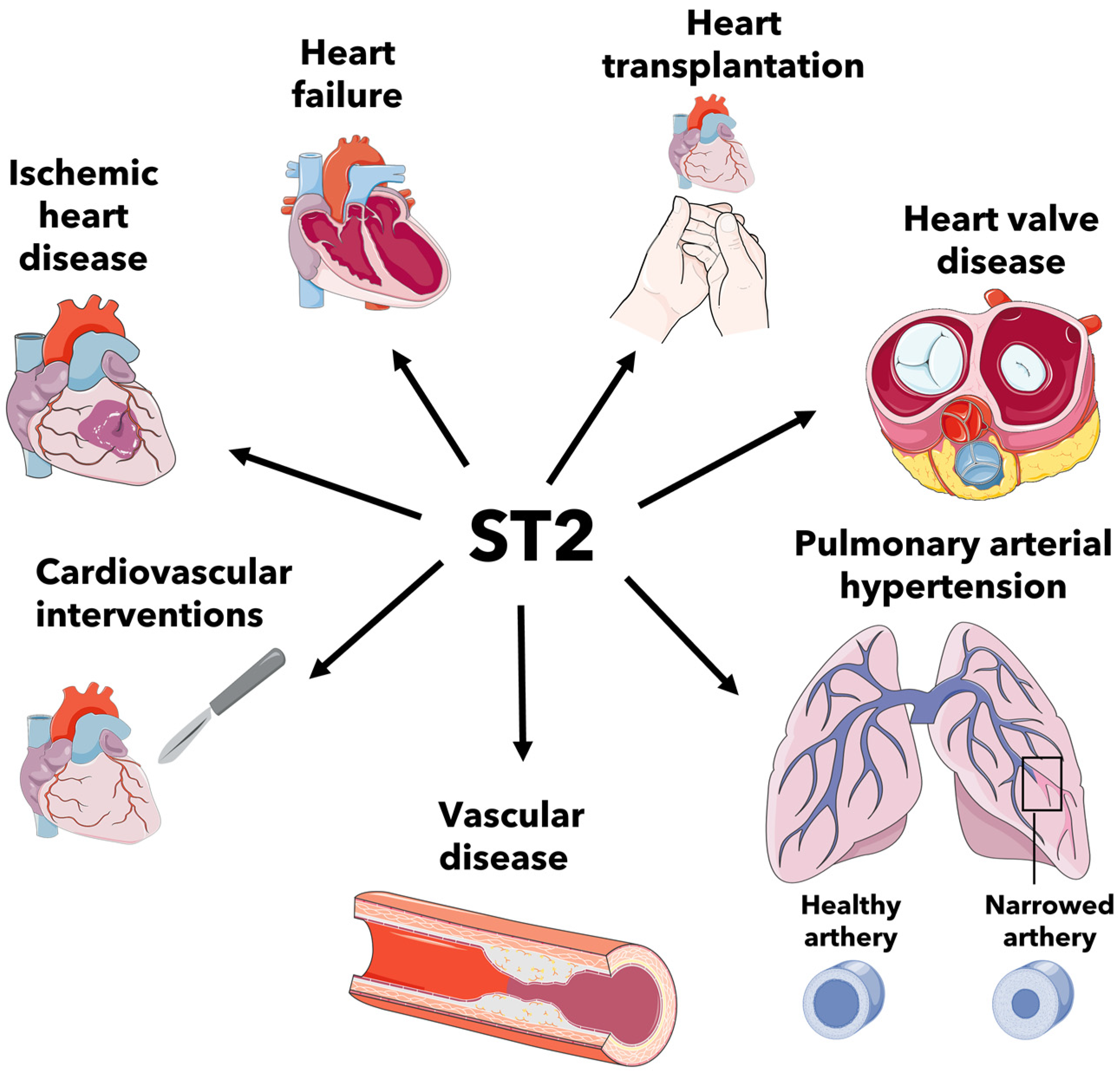 Biomedicines | Free Full-Text | The ST2/IL-33 Pathway in Adult and ...