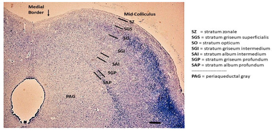 Involvement of the Superior Colliculus in SIDS Pathogenesis