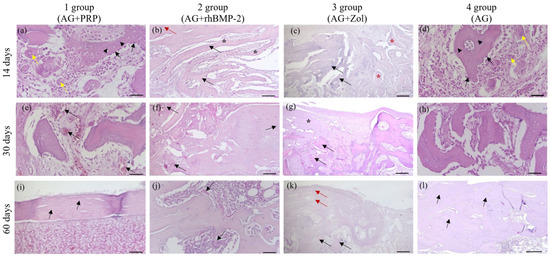 Evaluation of Bone Regenerative Capacity in Rabbit Femoral Defect Using ...