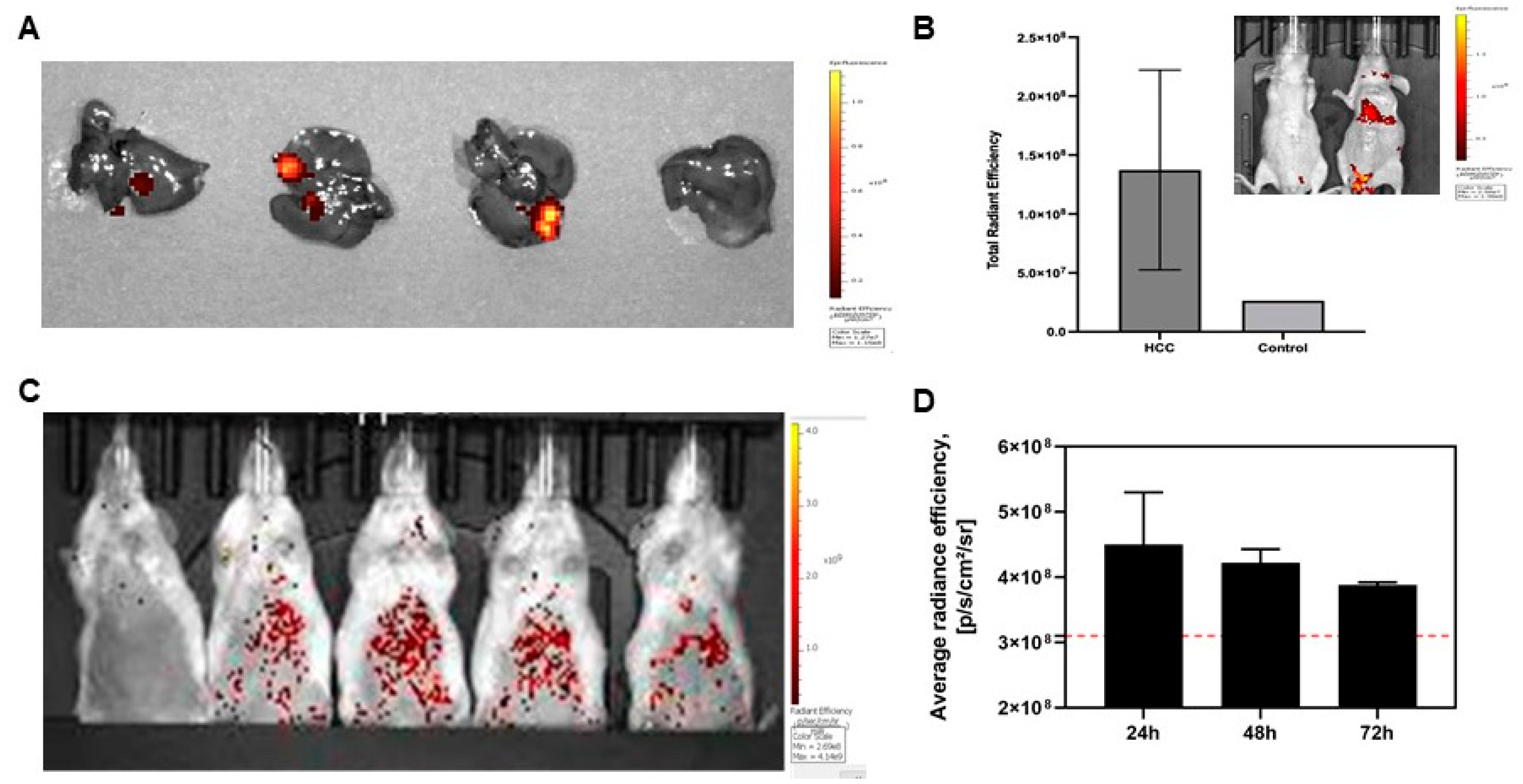 Delivery of Lipid Nanoparticles with ROS Probes for Improved Visualization of Hepatocellular ...