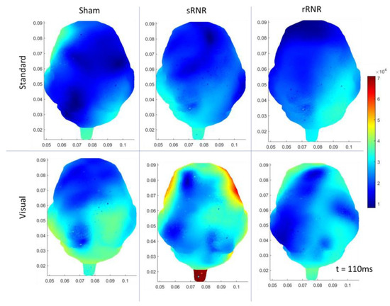 Altered Auditory and Visual Evoked Potentials following Single and ...