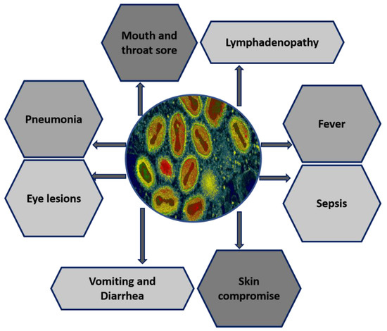 Biomedicines | Free Full-Text | An Updated Review on Monkeypox Viral ...