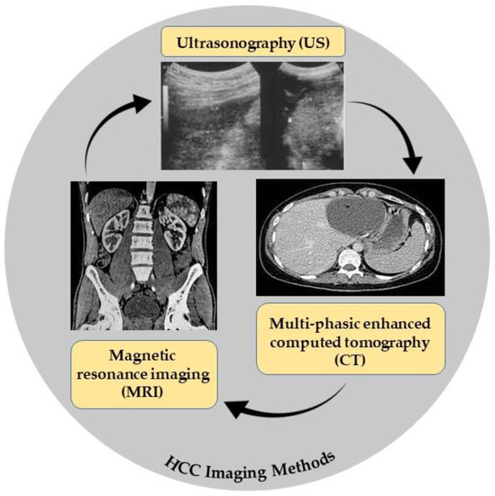 Biomarkers for Hepatocellular Carcinoma: From Origin to Clinical Diagnosis