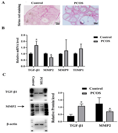 Abnormal Expression of Prolyl Oligopeptidase (POP) and Its Catalytic ...