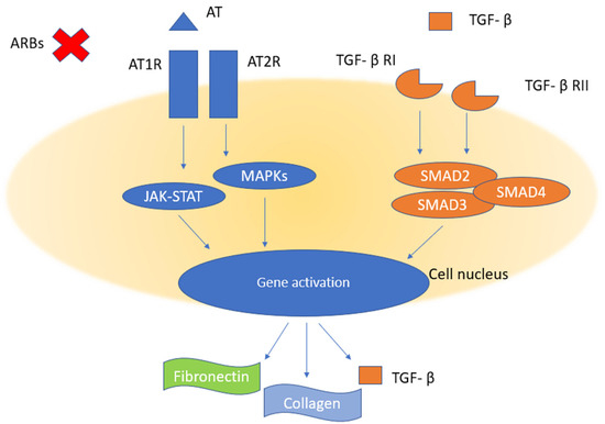 Spontaneous Epiretinal Membrane Resolution and Angiotensin Receptor ...
