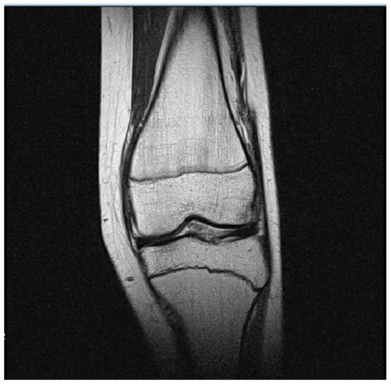 Improving the Age Estimation Efficiency by Calculation of the Area ...