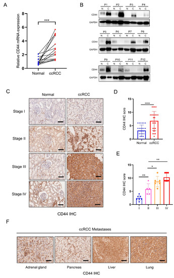 CD44 Is Associated with Poor Prognosis of ccRCC and Facilitates ccRCC ...