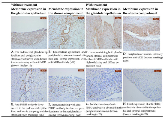 Vitamin D and Mitosis Evaluation in Endometriosis: A Step toward ...