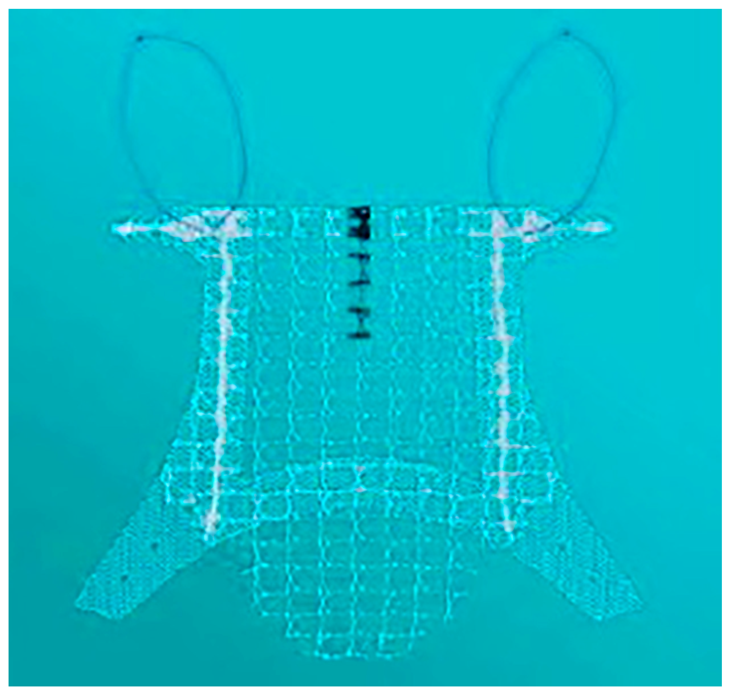 Robot Assisted Sacrocolpopexy Versus Trans Vaginal Multicompartment