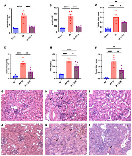Kinin B1 Receptor Antagonism Prevents Acute Kidney Injury to Chronic ...