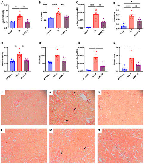 Kinin B1 Receptor Antagonism Prevents Acute Kidney Injury to Chronic ...