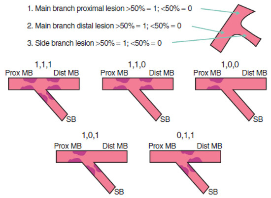 T and Small Protrusion (TAP) Technique in Bifurcations: Coronary Artery ...