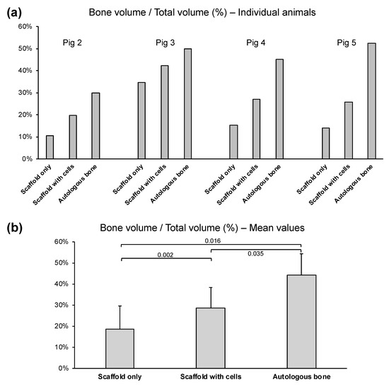 Alveolar Ridge Augmentation with a Novel Combination of 3D-Printed ...