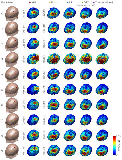 Optimizing TMS Coil Placement Approaches for Targeting the Dorsolateral ...