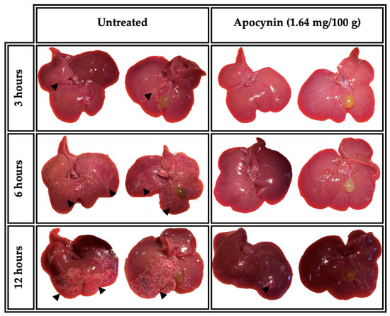 Apocynin, an NADPH Oxidase Enzyme Inhibitor, Prevents Amebic Liver ...