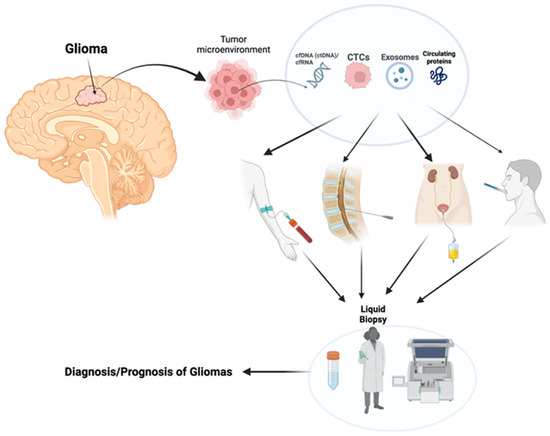 Biomedicines | Free Full-Text | Advances on Liquid Biopsy Analysis for Glioma Diagnosis