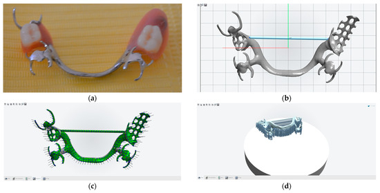 Research on the Quality of Partially Removable Skeletal Prostheses Made ...