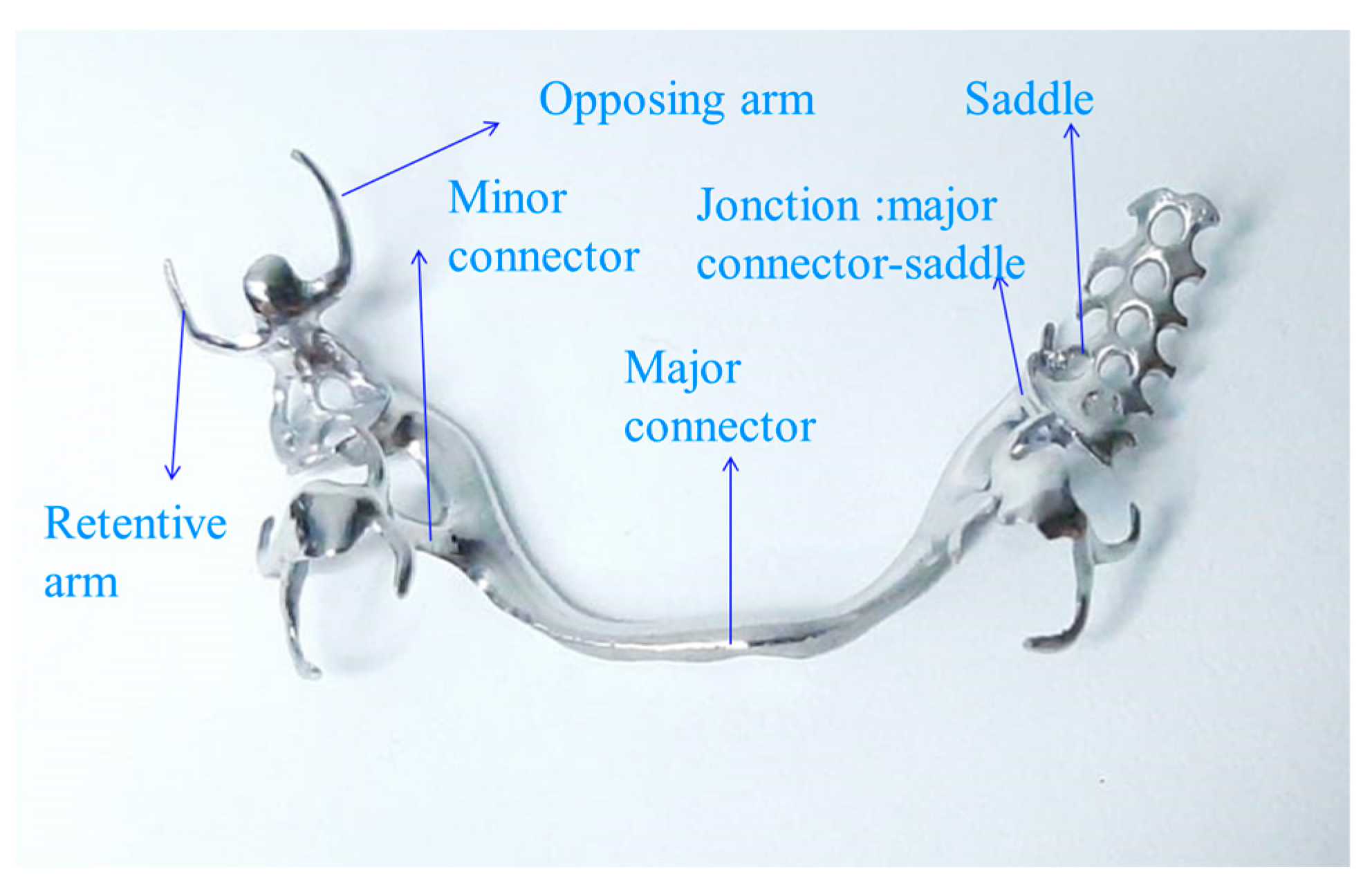Research on the Quality of Partially Removable Skeletal Prostheses Made ...