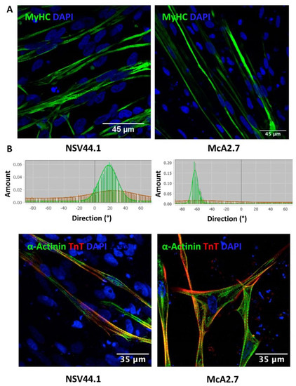 Creation of an iPSC-Based Skeletal Muscle Model of McArdle Disease ...