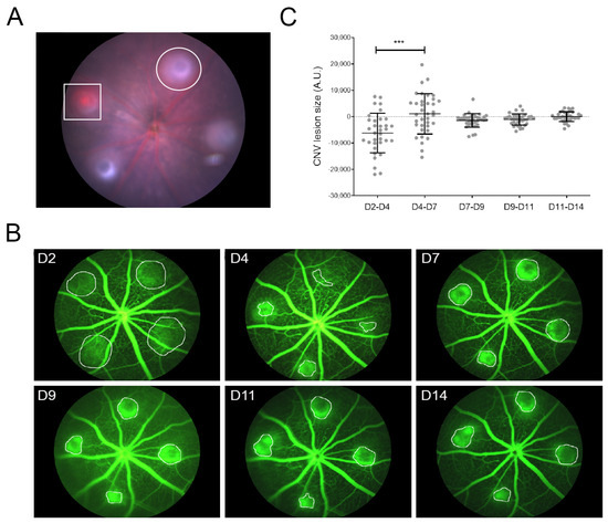 Neovascular Progression and Retinal Dysfunction in the Laser-Induced ...