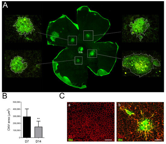 Neovascular Progression and Retinal Dysfunction in the Laser-Induced ...