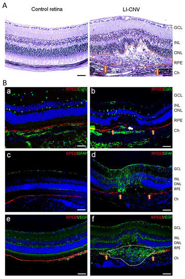 Neovascular Progression and Retinal Dysfunction in the Laser-Induced ...