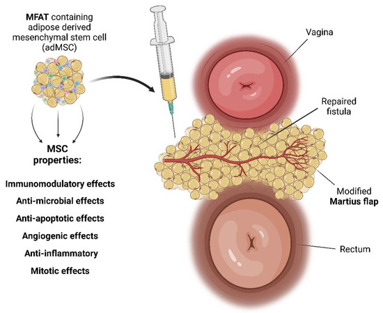 Biomedicines Free Full Text Novel Approach In Rectovaginal Fistula
