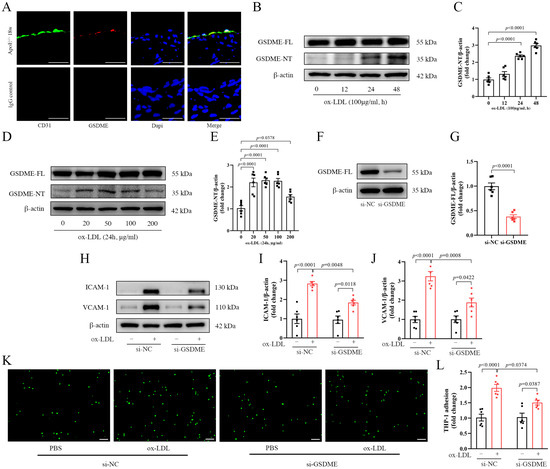GSDME in Endothelial Cells: Inducing Vascular Inflammation and ...