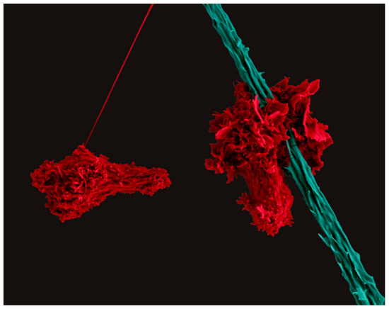 A History and Atlas of the Human CD4+ T Helper Cell