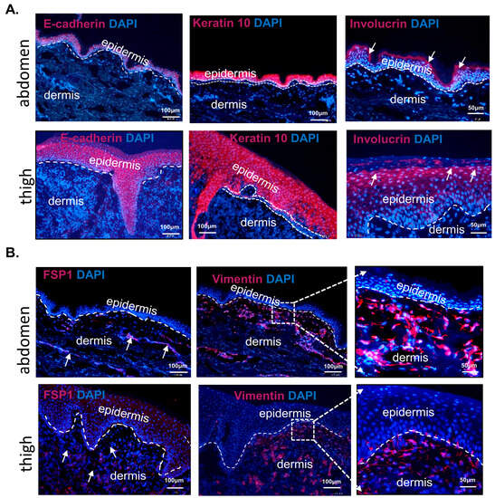 Gender Differences in Post-Operative Human Skin