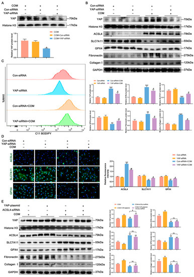 YAP/ACSL4 Pathway-Mediated Ferroptosis Promotes Renal Fibrosis in the ...