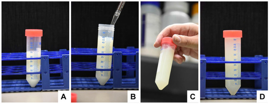 Isolation of Bovine and Human Milk Extracellular Vesicles